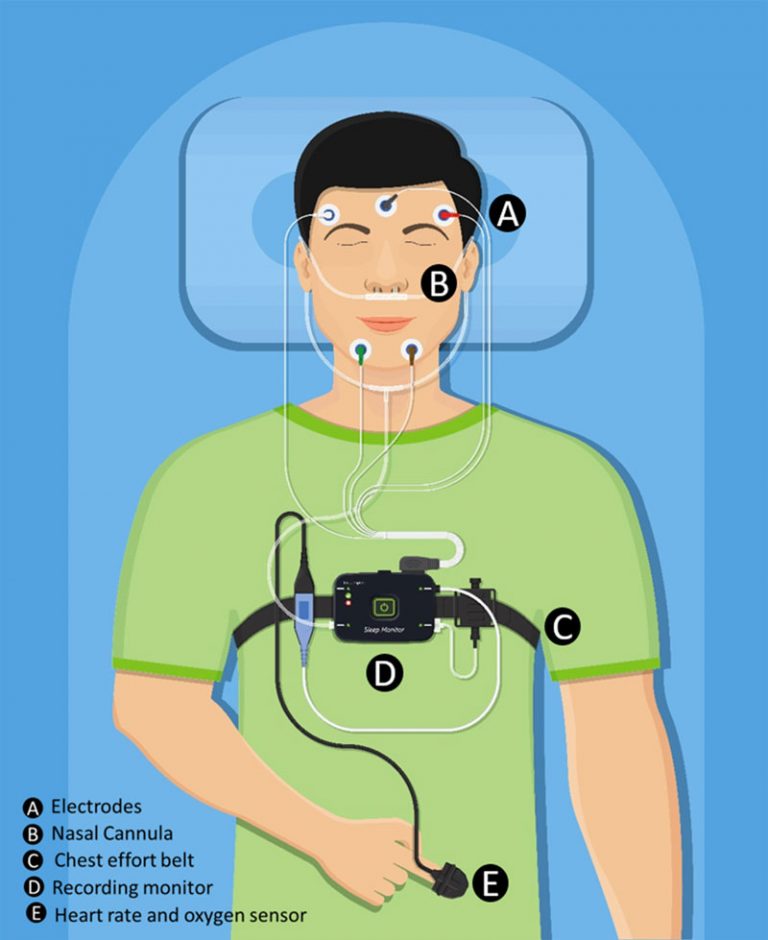 What is sleep? - SLEEP ON IT! - Public Health Campaign on Sleep